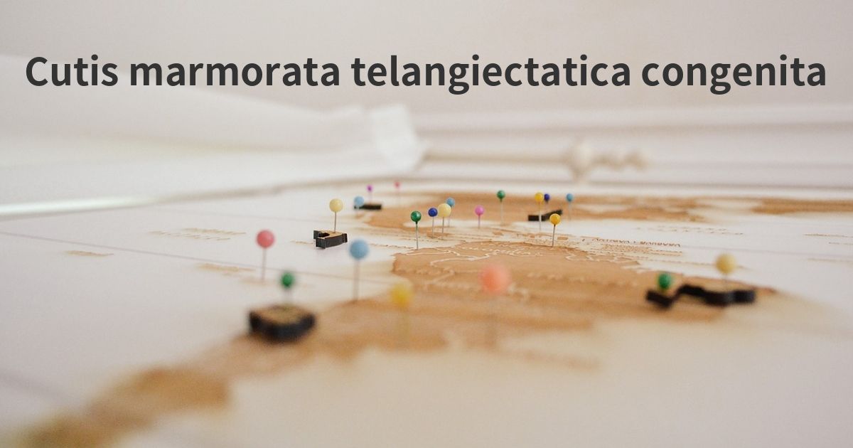 Cutis marmorata telangiectatica congenita | Diseasemaps