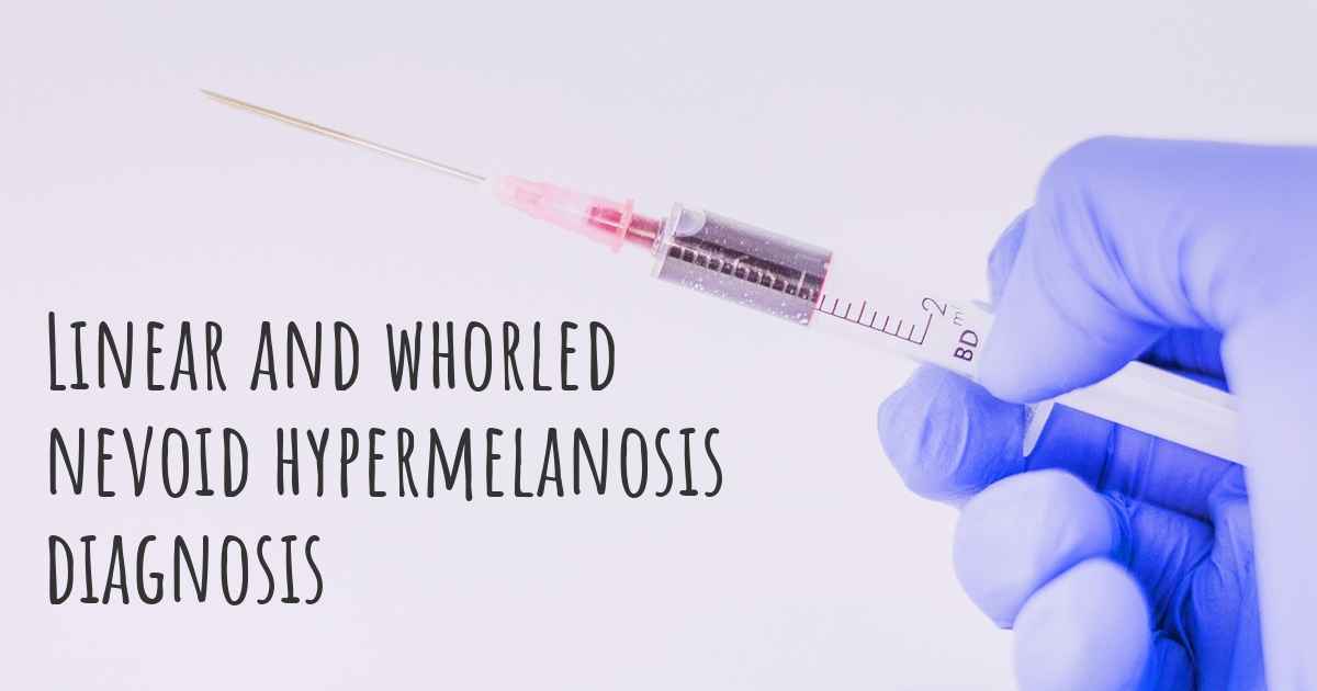 How is Linear and whorled nevoid hypermelanosis diagnosed?