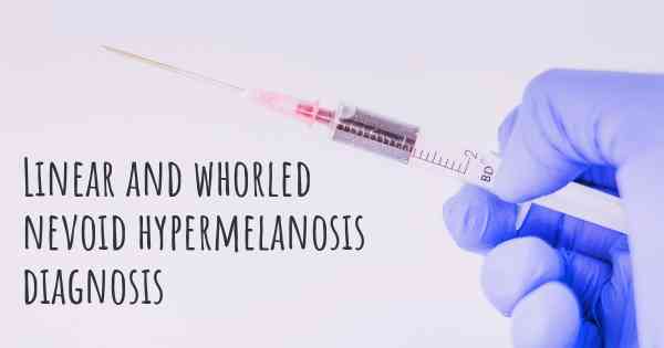 How is Linear and whorled nevoid hypermelanosis diagnosed?